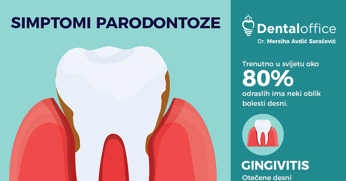Simptomi parodontoze, dr. Mersiha Avdić-Saračević: Značaj ranog ...