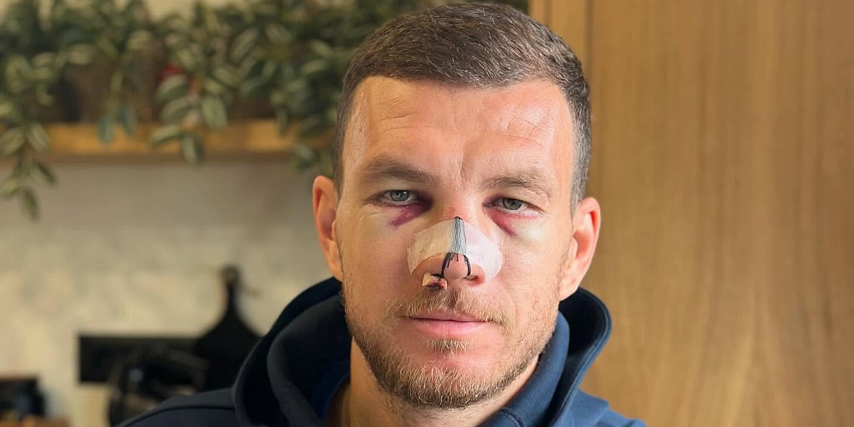 Džeko pokazao kako izgleda pred duel s Kiprom, pjesmom iz filma Rocky ...