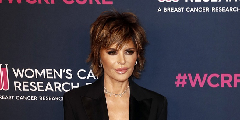 Lisa Rinna otkrila kako ju je bivši kolega zlostavljao na setu: "Učinio ...